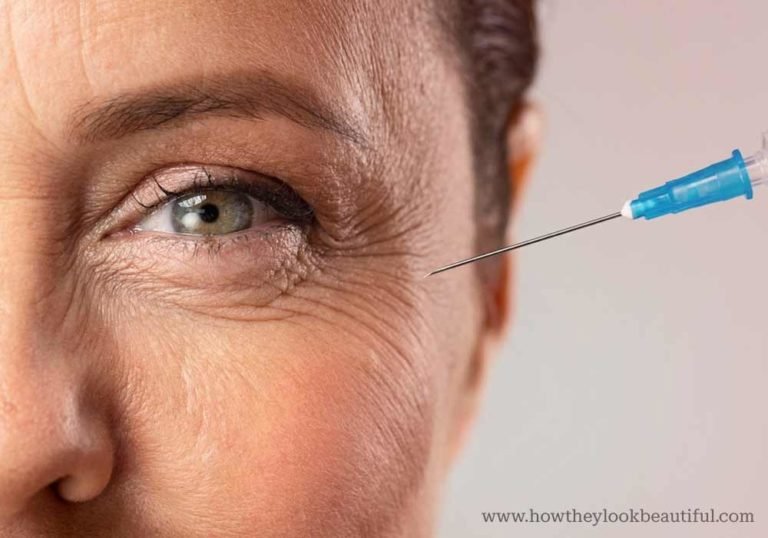 Where on Your Face Can You Get Botox Injected? (With Units)